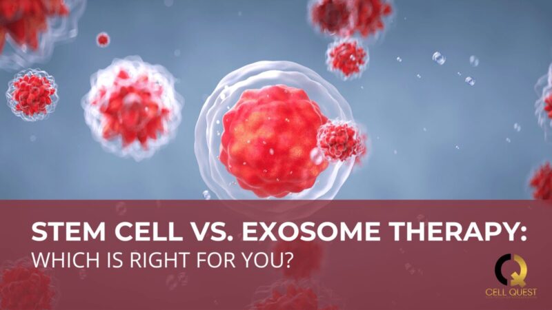 Stem Cell Therapy vs. Exosome Therapy: Which is Right for You?