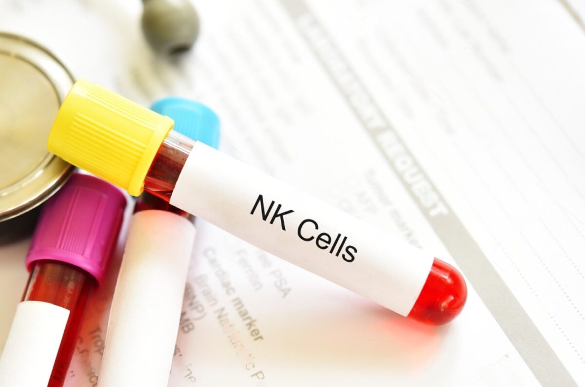 How NK Cell Therapy Boosts Your Immune System - Cell Quest How NK Cell ...
